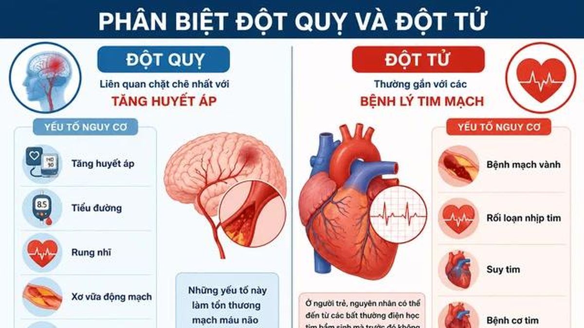 Phân biệt đột quỵ và đột tử trong những phút đầu sinh tử - Báo Tri thức ...