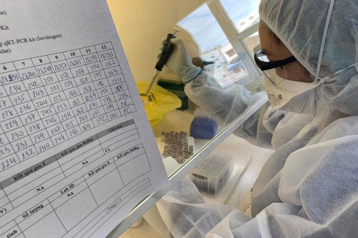 CDC TPHCM không mua kit test của công ty Việt Á vì giá quá đắt - Báo ...