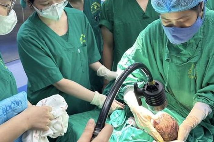 Cứu sống mẹ con sản phụ bị sản giật, tổn thương não - Báo Sức Khỏe ...