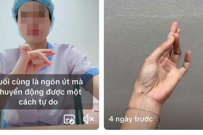 Bác sĩ tim mạch giải đáp về clip hướng dẫn kiểm tra đột quỵ bằng ngón ...