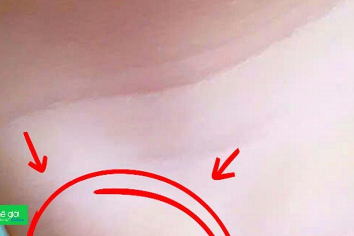 Hiểm họa từ lỗ nhỏ trên cổ trẻ: Cảnh báo rò khe mang bẩm sinh - Tạp chí ...