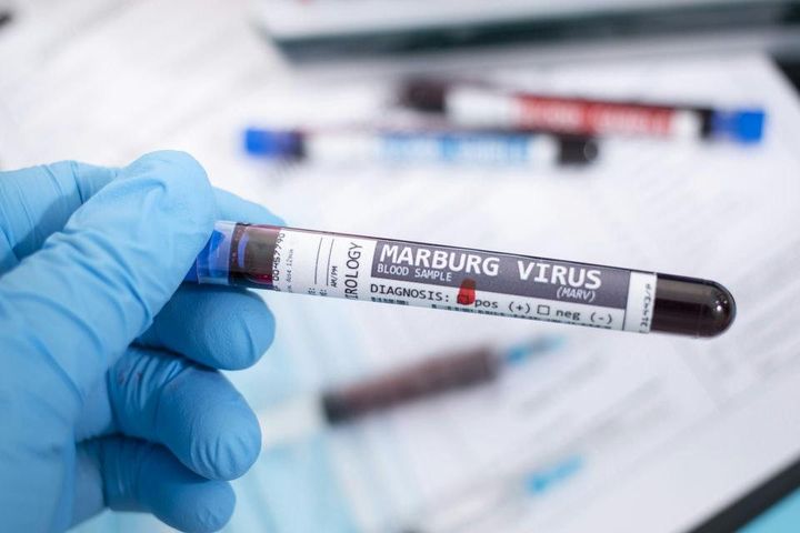 Nâng cao cảnh giác với virus Marburg vì chưa có vaccine phòng, tỷ lệ tử ...